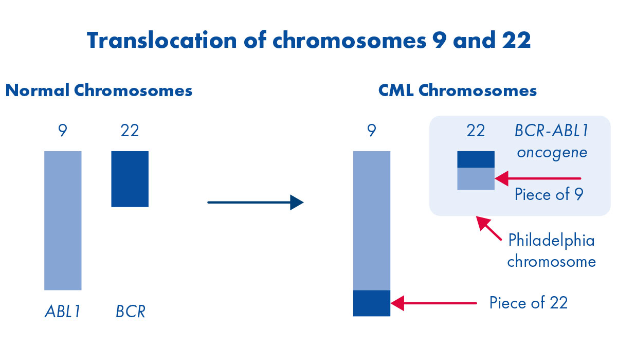 CML | Chronic myeloid leukemia | QIAGEN