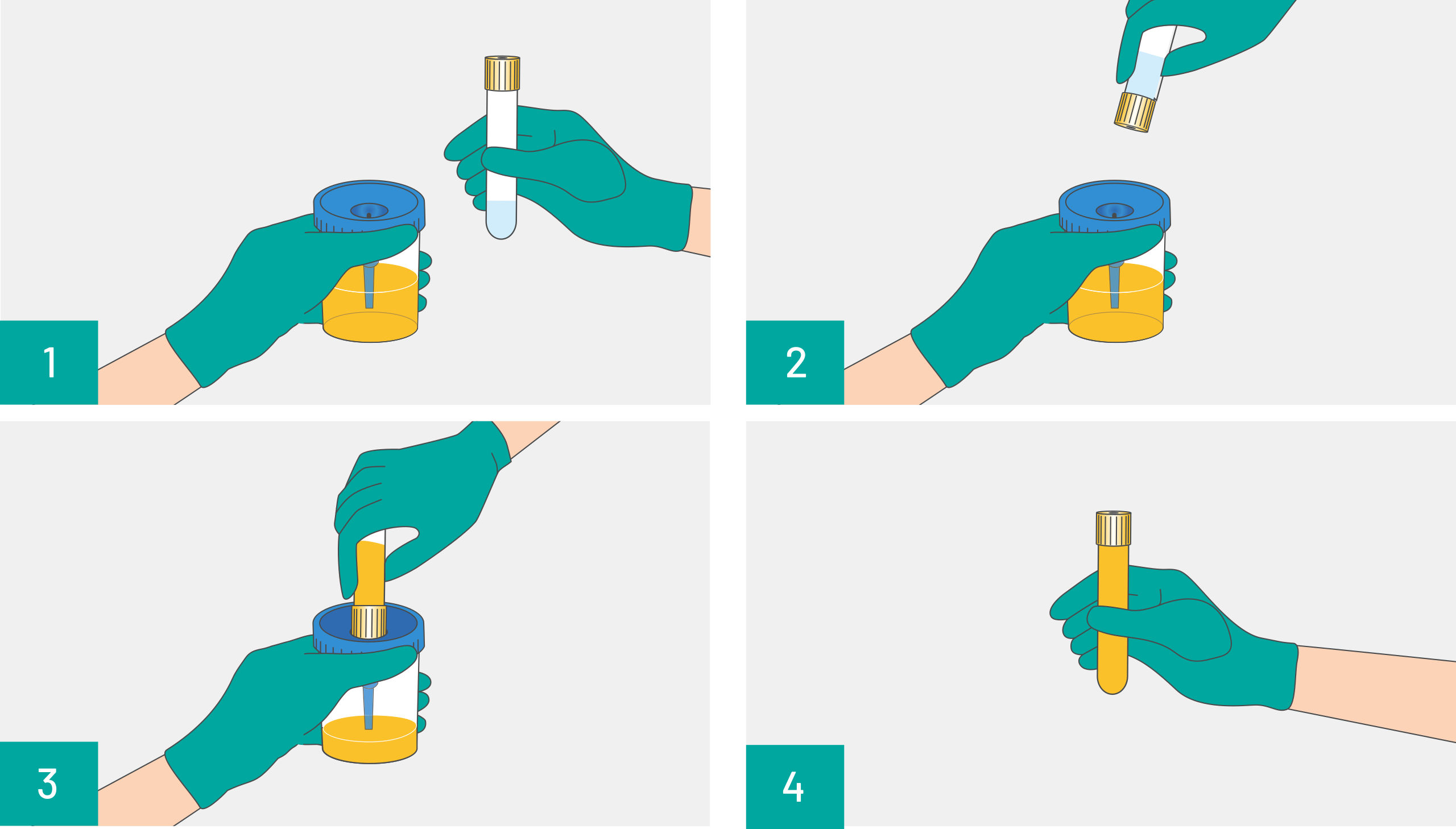 PAXgene Urine Liquid Biopsy Kit: cfDNA Collection & Preservation | QIAGEN